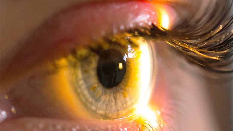 International patients | Barraquer Ophthalmology Centre