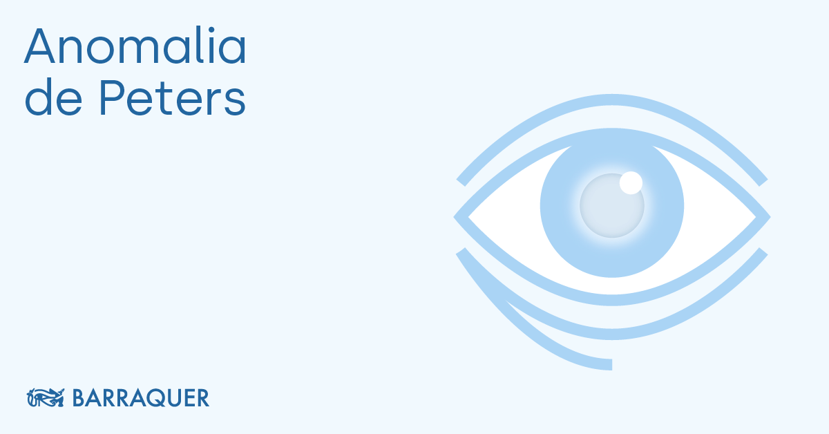 Anomalía de Peters | Causas, Síntomas y Tratamiento - Barraquer