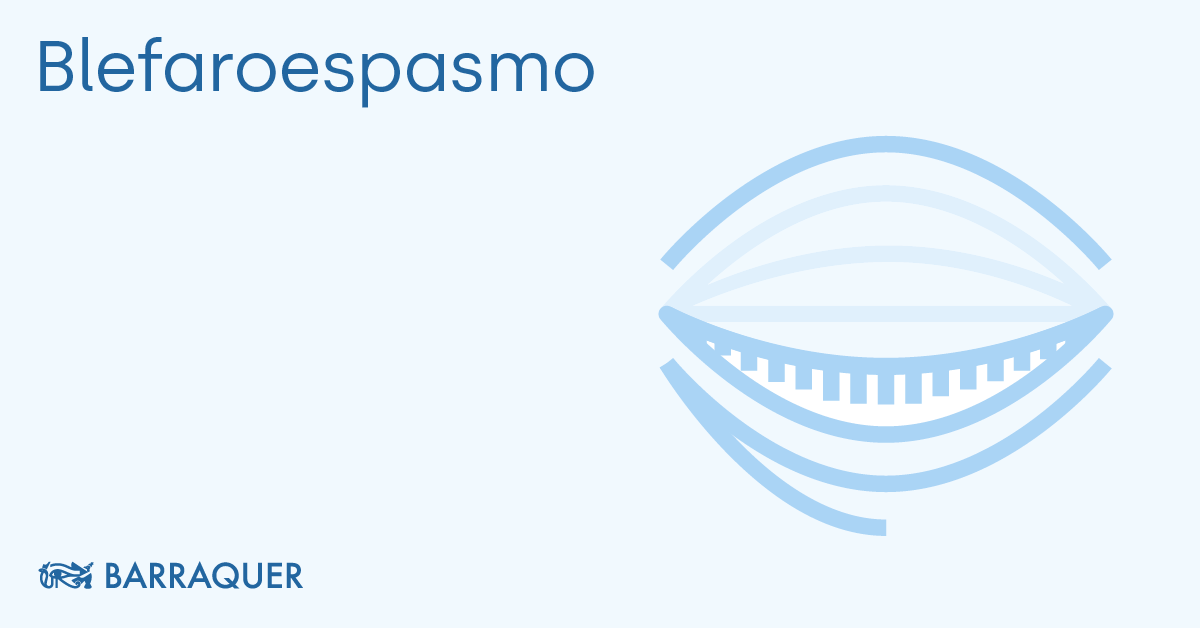 Blefarospasmo | Contrazioni delle palpebre - Barraquer