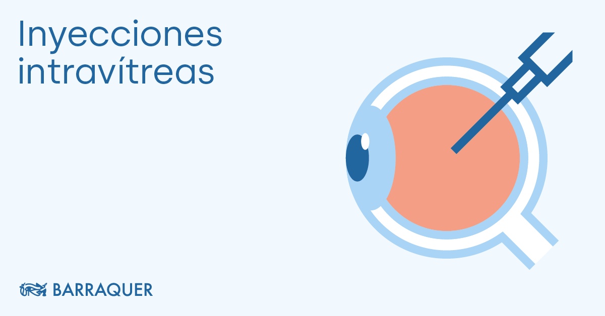 Técnica de Inyecciones Intravítreas - Centro Barraquer