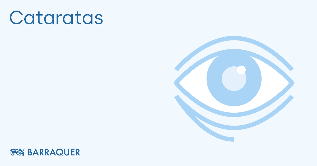 Cataratas en los Ojos | Qué son, Síntomas y Tratamiento - Barraquer