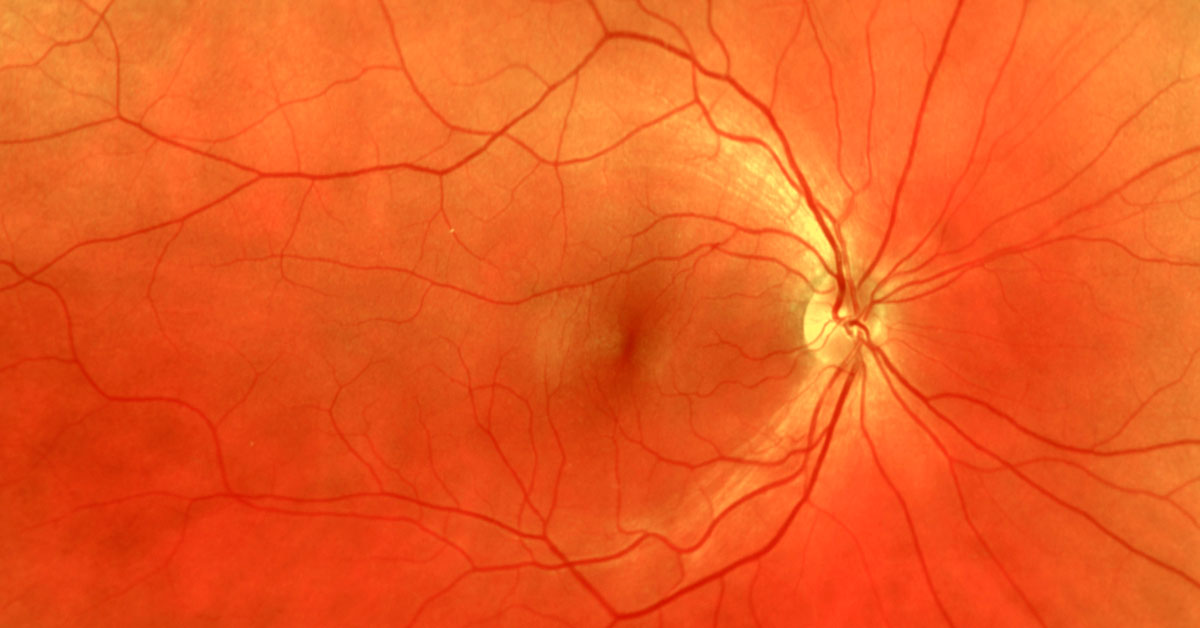 Posterior Segment Of The Eye