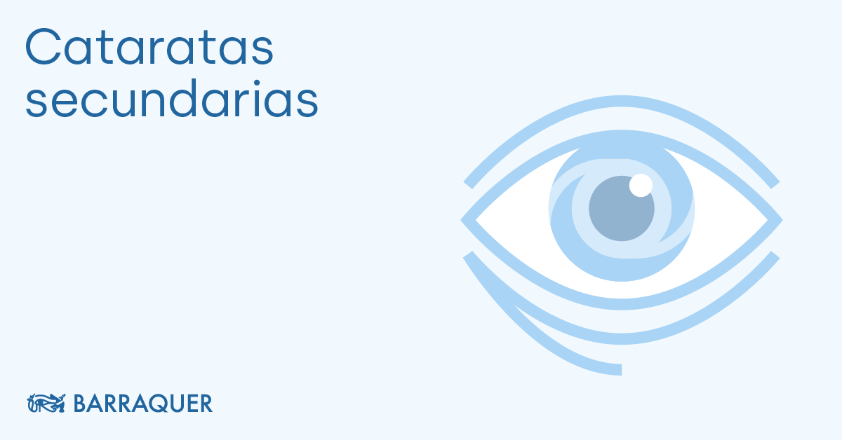Cataratas Secundarias | Qué son, Causas y Tratamiento